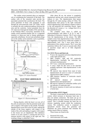 Denoising of ECG -- A discrete time approach using DWT. | PDF