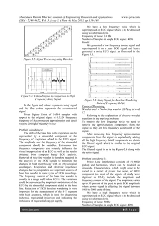 Denoising of ECG -- A discrete time approach using DWT. | PDF