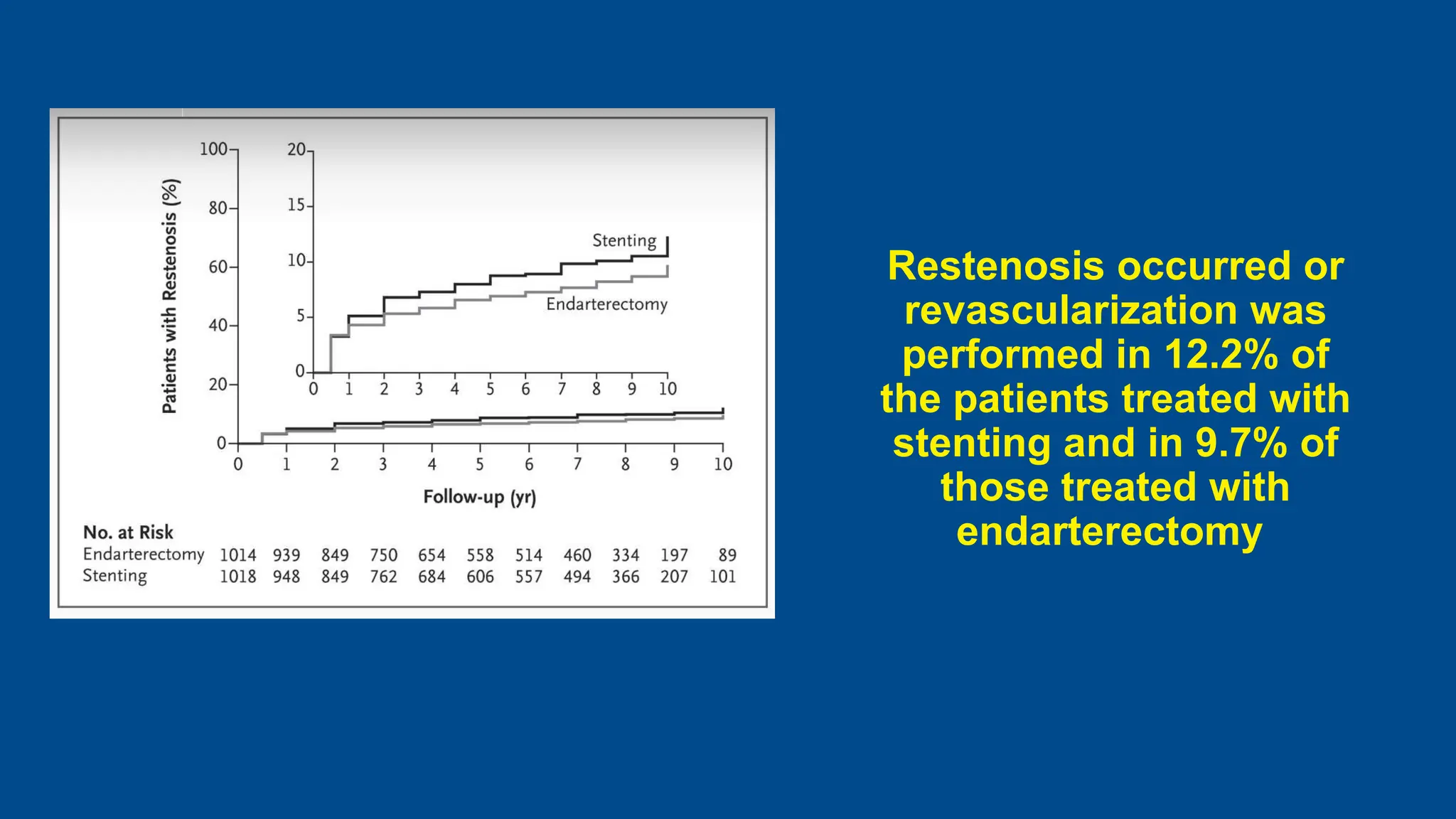 CREST & NASCET trials on Carotid Artery Disease pptx | PPT
