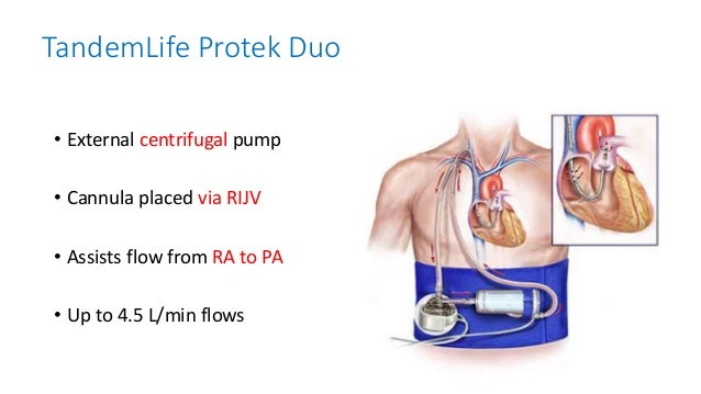RVADs/LVADs and all things mechanical by Dr Jayshree Lavana