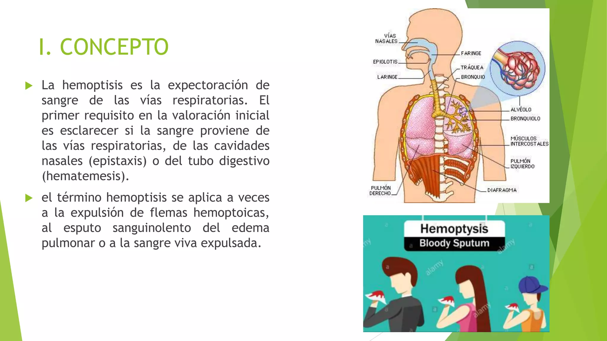 UANCV-MEDICINA HUMANA-NEUMOLOGIA-HEMOPTISIS | PPTX