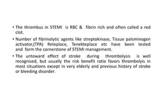 ua nstemi.pptx