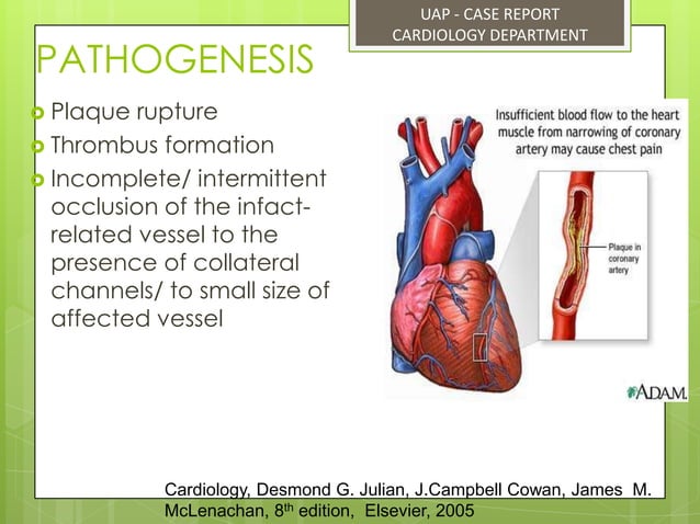 Unstable Angina Pectoris | PPTX | Heart and Cardiovascular Diseases | Diseases and Conditions