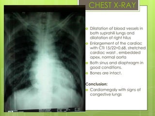 Unstable Angina Pectoris | PPTX