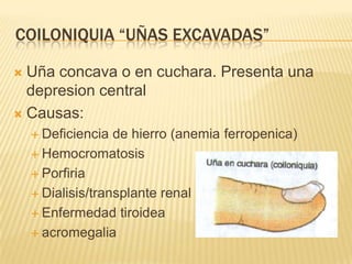 Uñas. SEMIOLOGIA. ALTERACIONES | PPTX