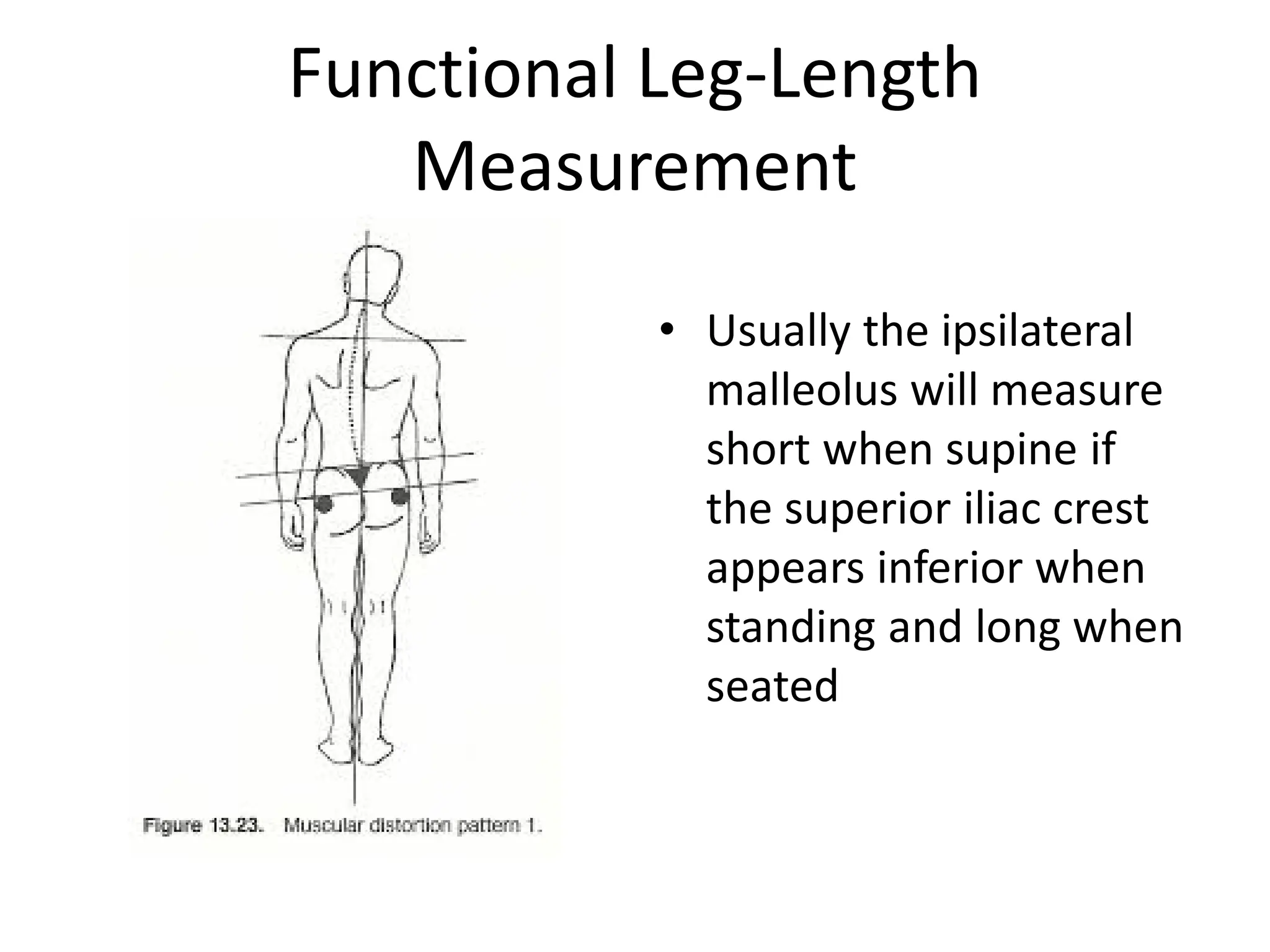ub-hsped-scoliosis-differential-dx-functional-and-structural-scoliosis.pdf