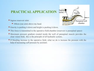 Water dynamic of UBE Unilateral Biportal Endoscopy.pptx