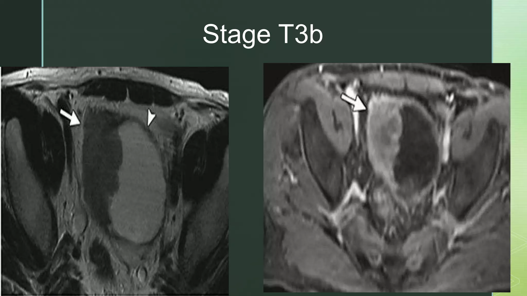 Urinary Bladder imaging | PPTX | Pregnancy | Reproductive Health