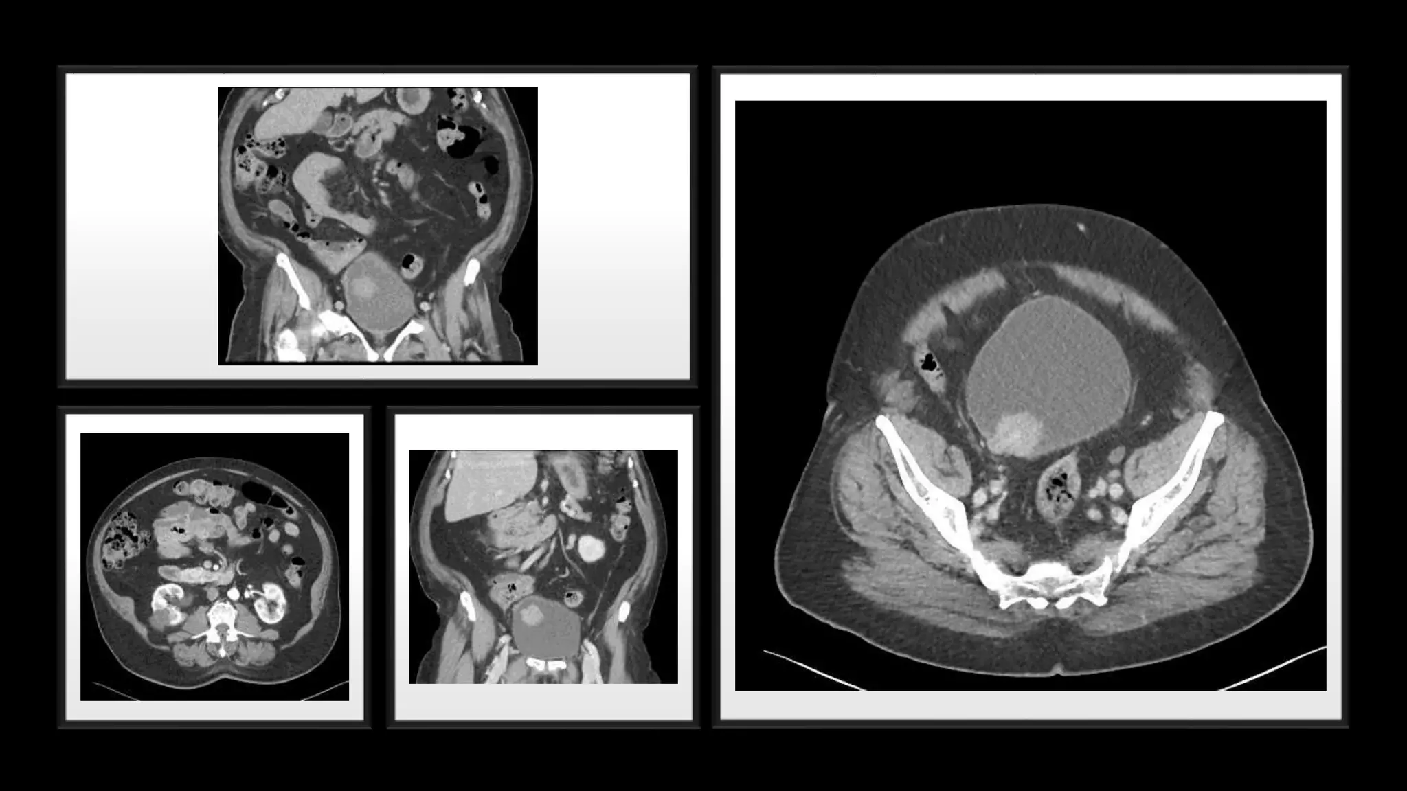 Urinary Bladder imaging | PPTX | Pregnancy | Reproductive Health