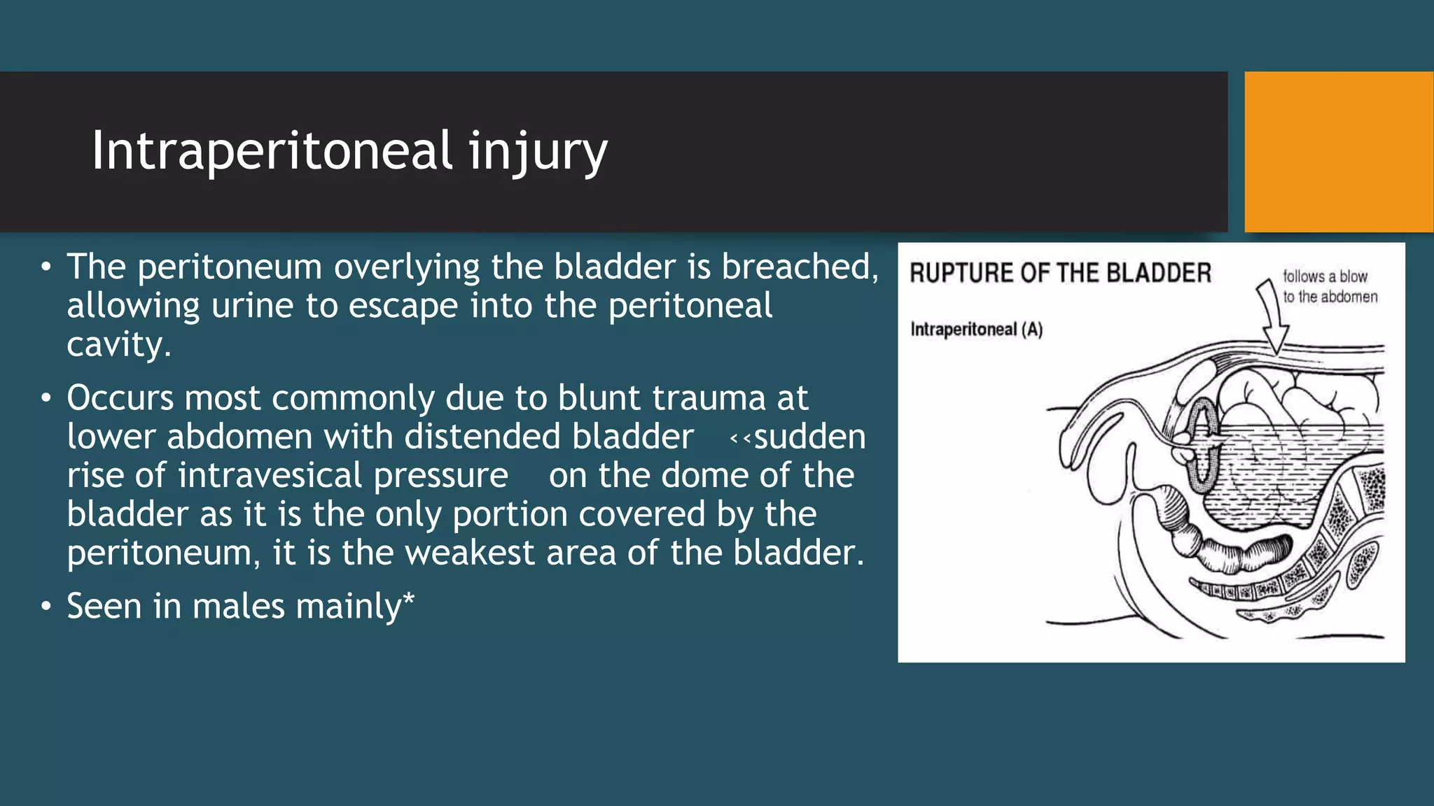 Urinary bladder trauma.pptx