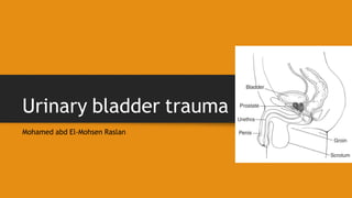 Urinary bladder trauma.pptx