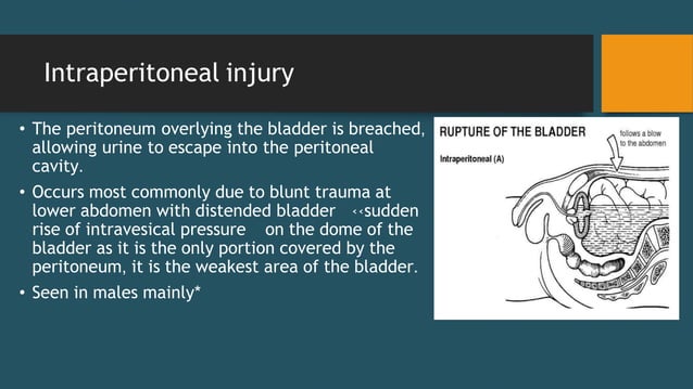 Urinary bladder trauma.pptx