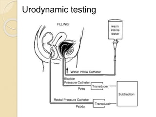Urinary incontinence | PPT