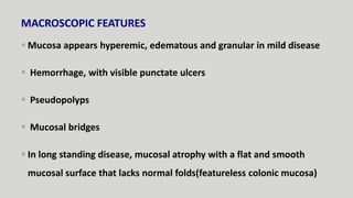 ULCERATIVE COLITIS MANAGEMENT | PPTX