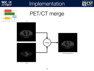 Automating Lung Cancer Identification in PET/CT Imaging | PDF