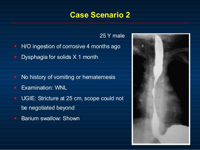 Corrosive esophageal injury