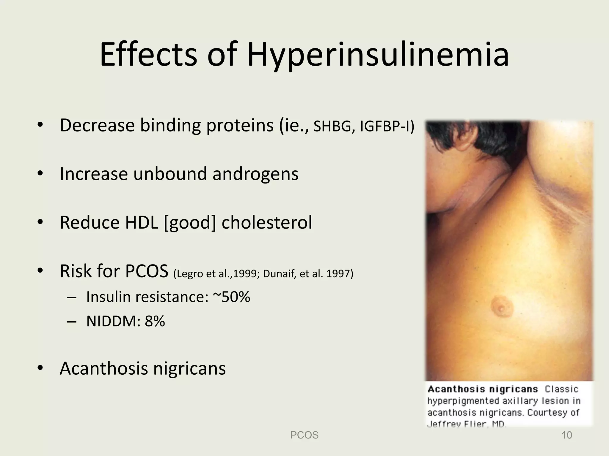 Polycystic Ovary Syndrome (PCOS) | PDF