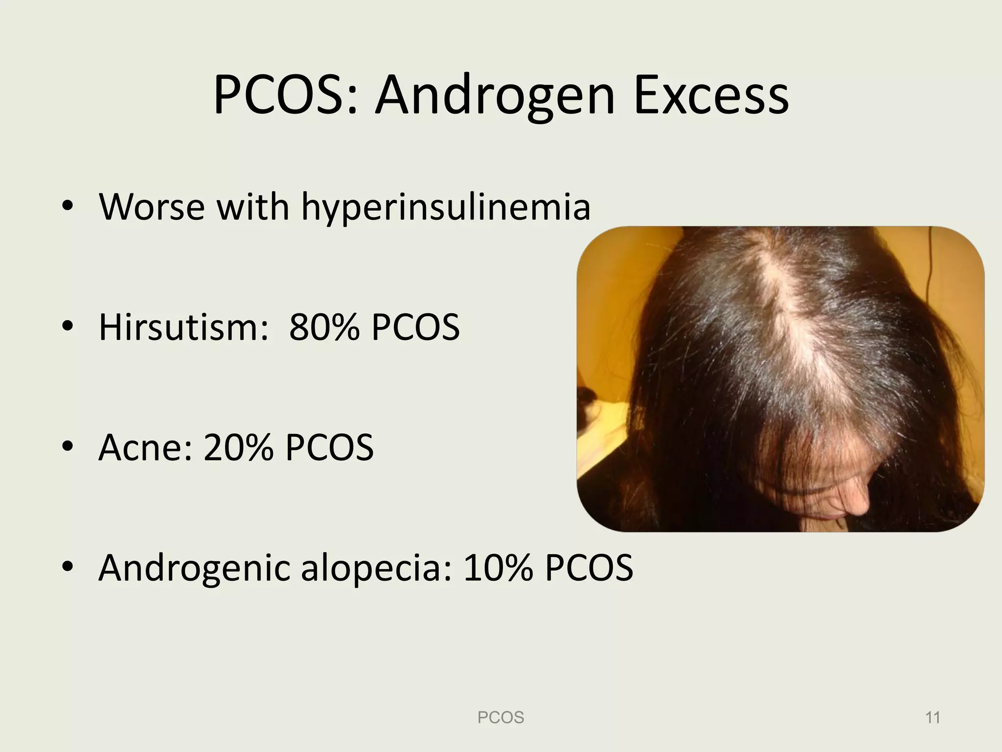 Polycystic Ovary Syndrome (PCOS) | PDF