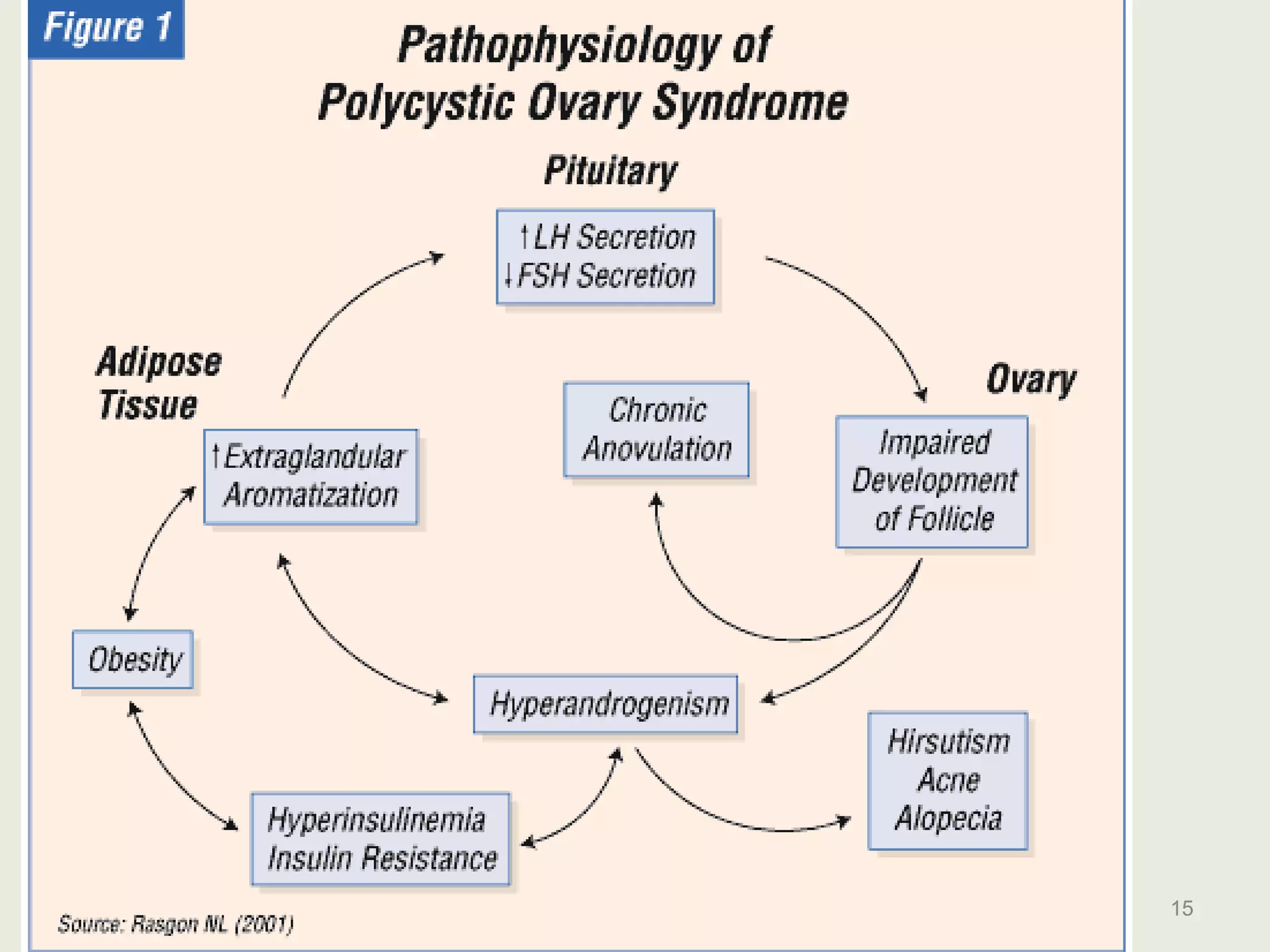 Polycystic Ovary Syndrome (PCOS) | PDF