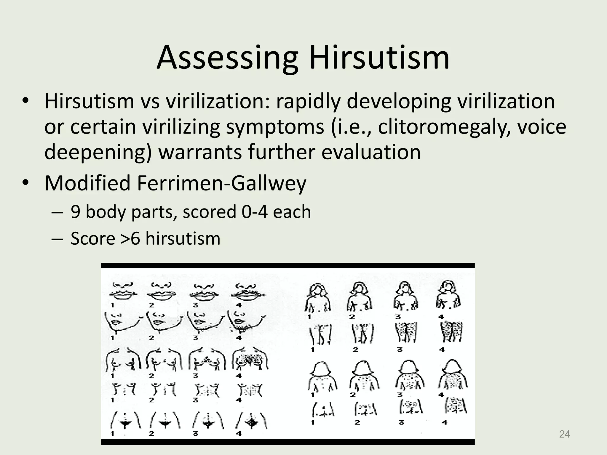 Polycystic Ovary Syndrome (PCOS) | PDF