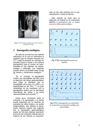 Estudios funcionales del esófago | PDF