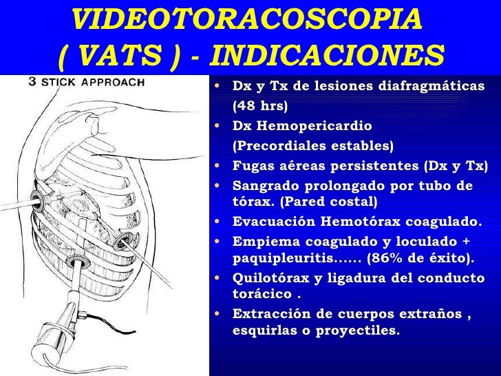 Ucitraumatorax ii