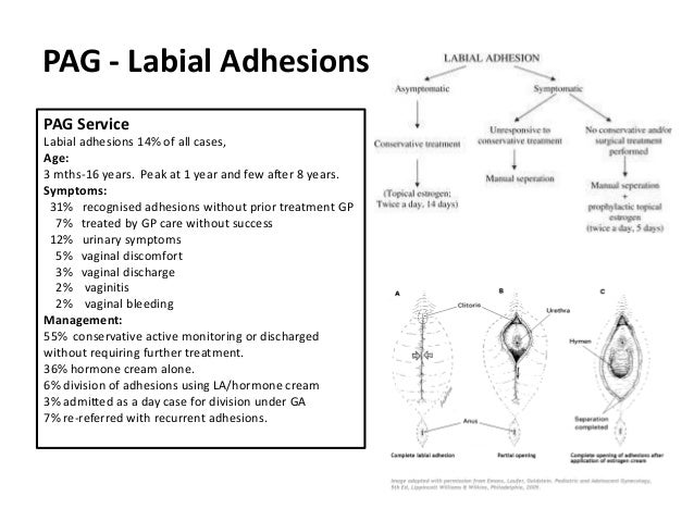 Paediatric & Adolescent Gynaecology