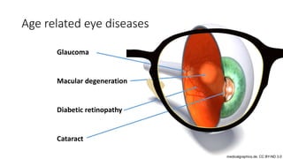 Ucsd vision and aging (3) | PPT
