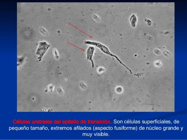Ud 18. iv. análisis del sedimento urinario. ppt