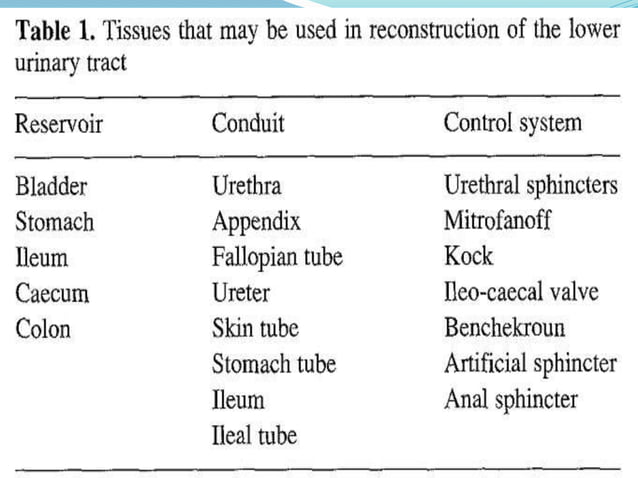 Urinary diversion by dr burhan kaydawla | PPTX