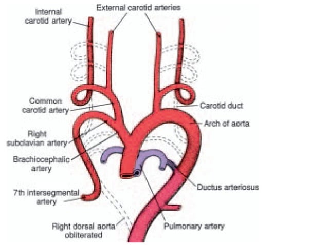 Development of arterial system | PPT | Lung and Respiratory Health ...