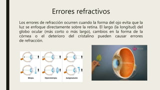 Errores de refracción | PPTX