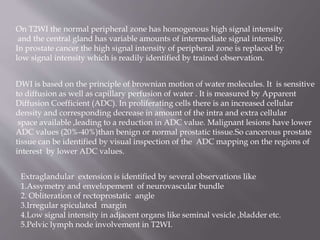 Role of diffusion weighted magnetic resonance imaging in | PPTX