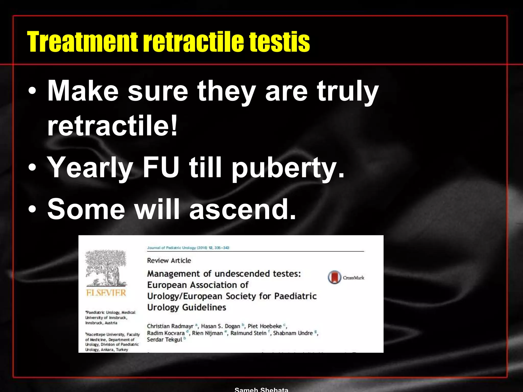 Undescended testis , Guidelines for managment | PPTX