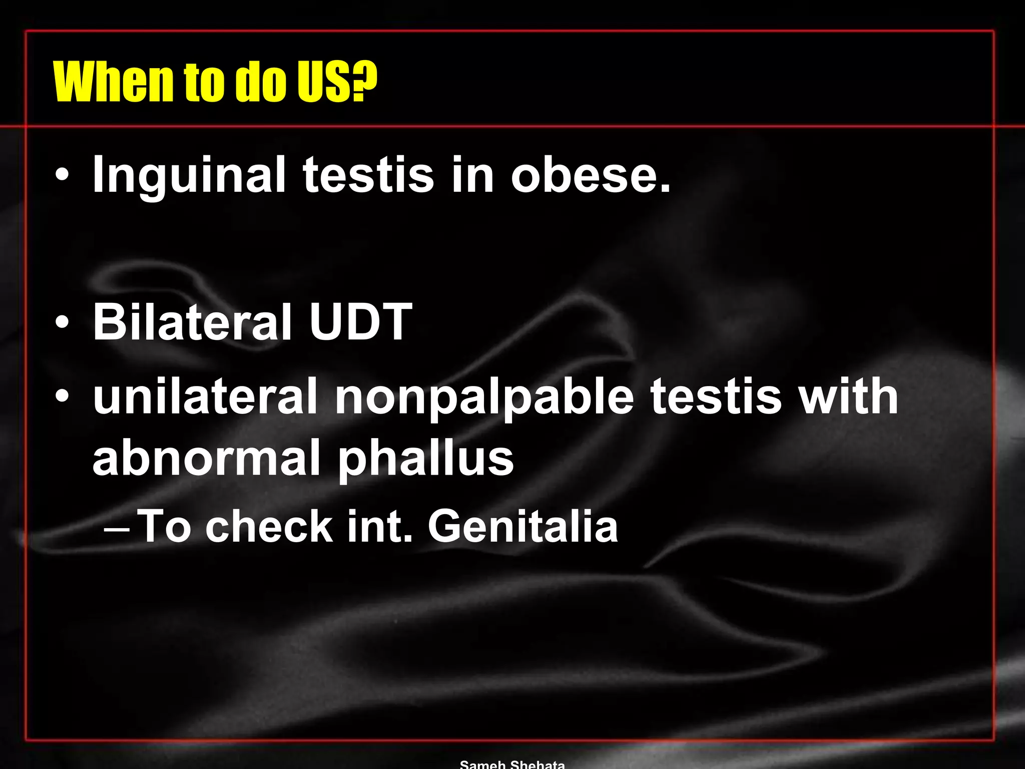 Undescended testis , Guidelines for managment | PPTX