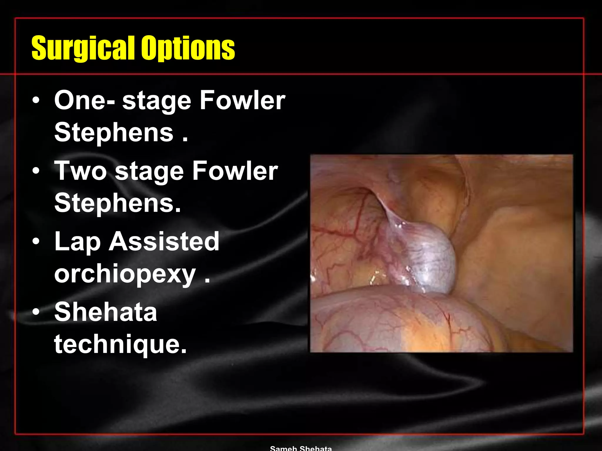 Undescended testis , Guidelines for managment | PPTX