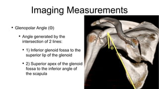 Scapula Fractures classification and manegment | PDF