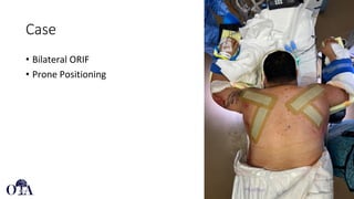 Scapula Fractures classification and manegment | PDF