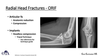 UE 9 Radial Head and Neck Fractures. pdf | PDF