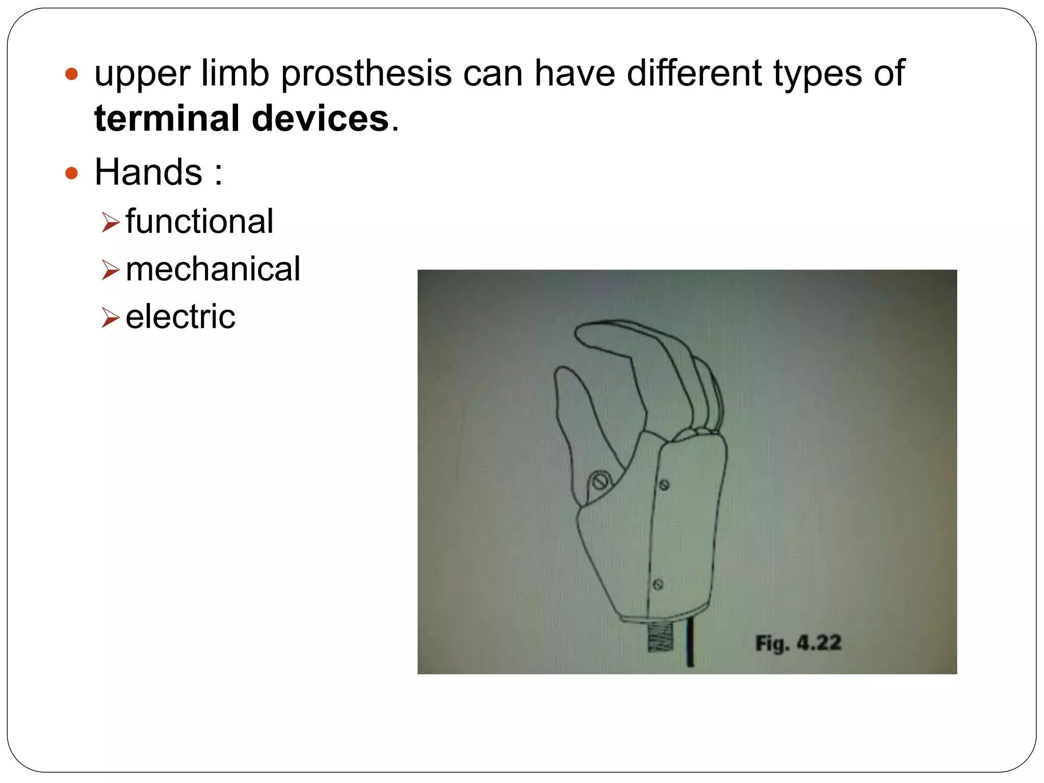 Rehabilitation of Upper Limb Amputee | PPTX