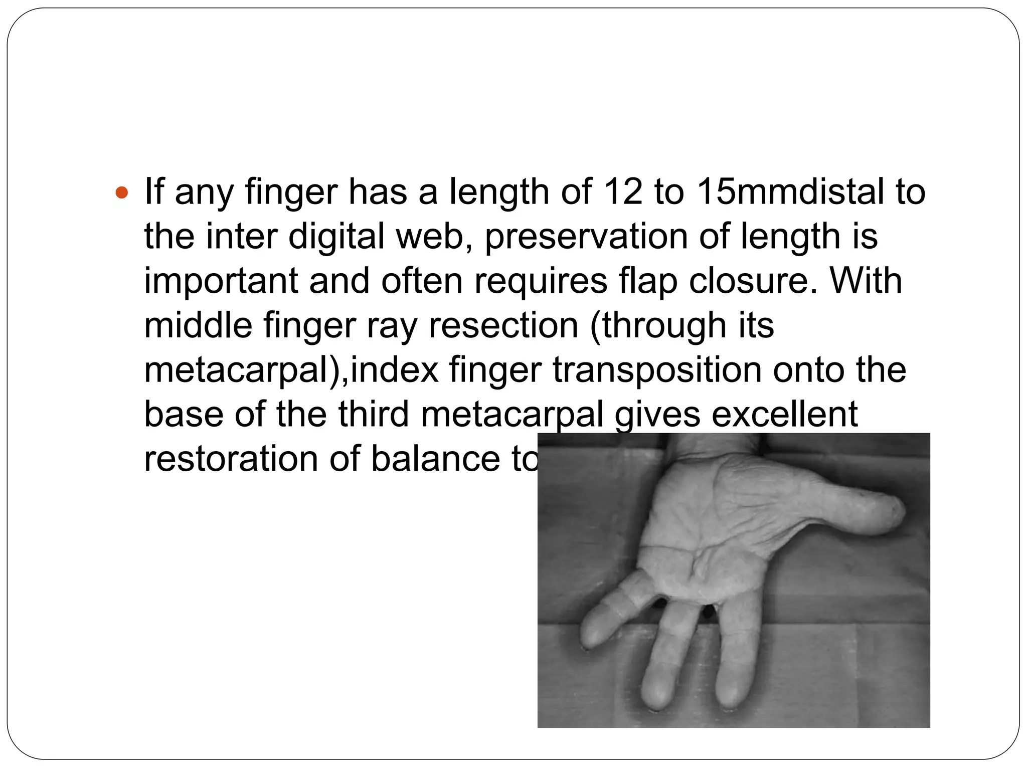 Rehabilitation of Upper Limb Amputee | PPTX