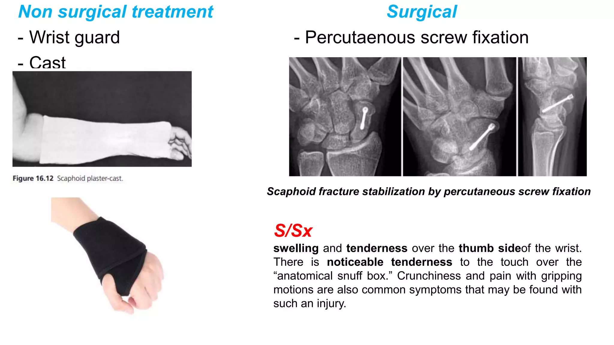 Upper and Lower Extremity fractures | PPTX
