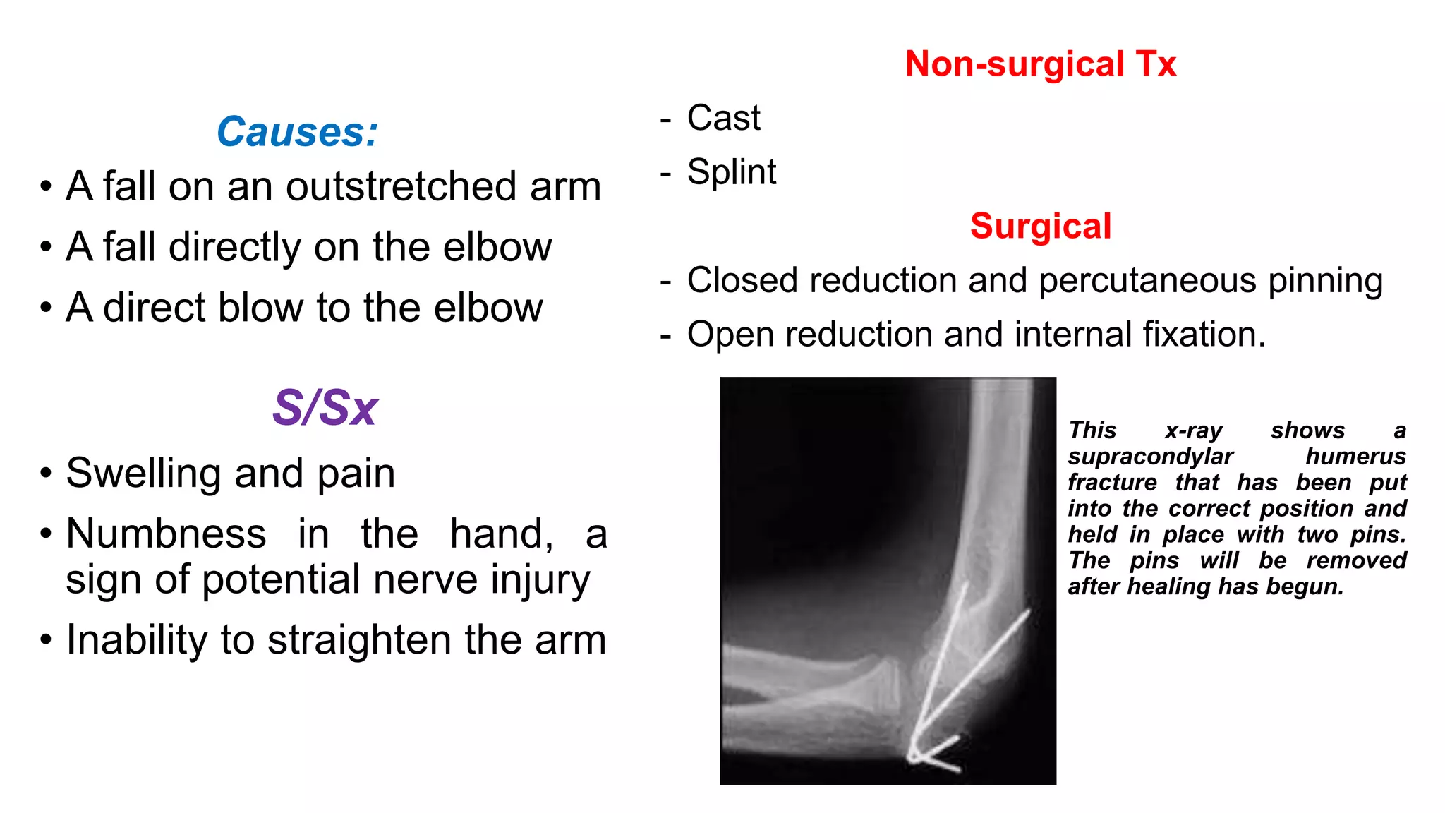 Screening For Lower Extremity Fractures – MYVEF