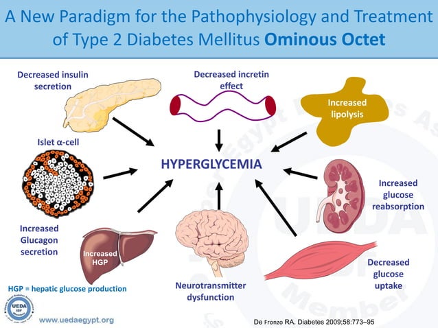 Ueda 2016 2-pathophysiology ,classification & diagnosis of diabetes ...