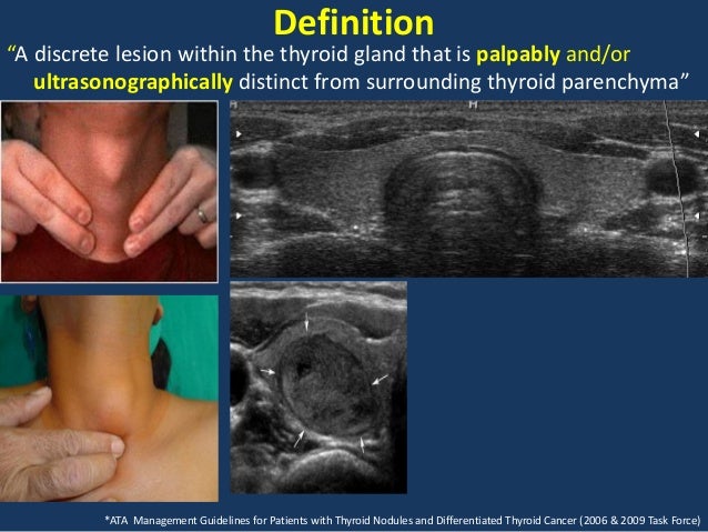 Ueda2016 thyroid nodule in practice - khaled el hadidy