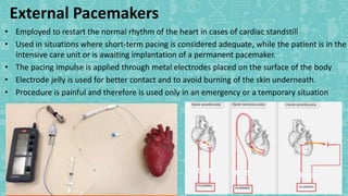 Medical instrumentation- cardiac arrhythmia, pacemaker, defibrillator | PPT
