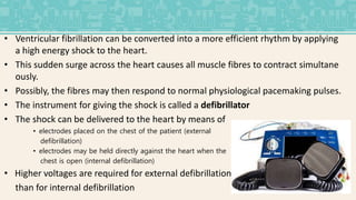 Medical instrumentation- cardiac arrhythmia, pacemaker, defibrillator | PPT