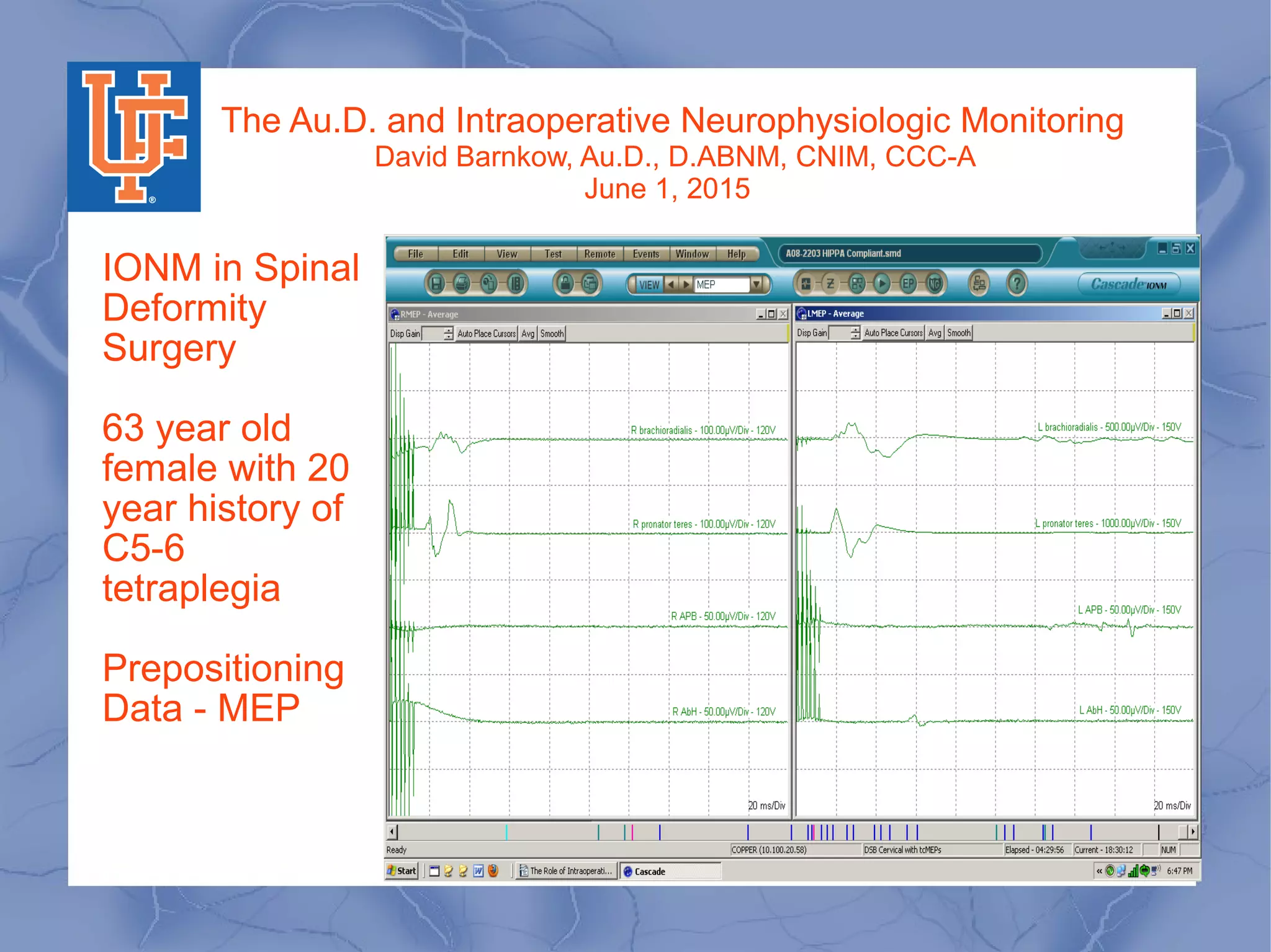 The Au.D. and Intraoperative Neurophysiologic Monitoring | PPT