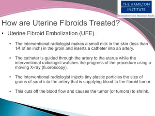 Uterine Fibroid Embolization | PPTX