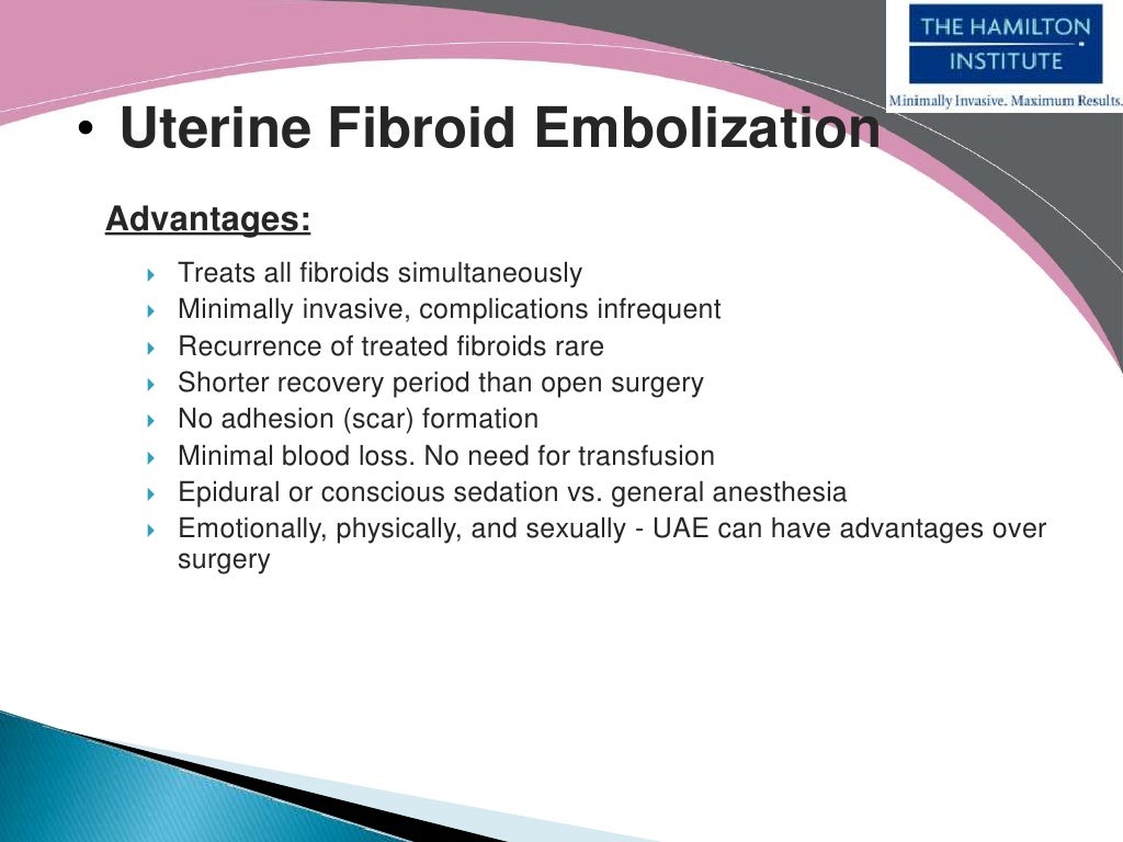 Uterine Fibroid Embolization